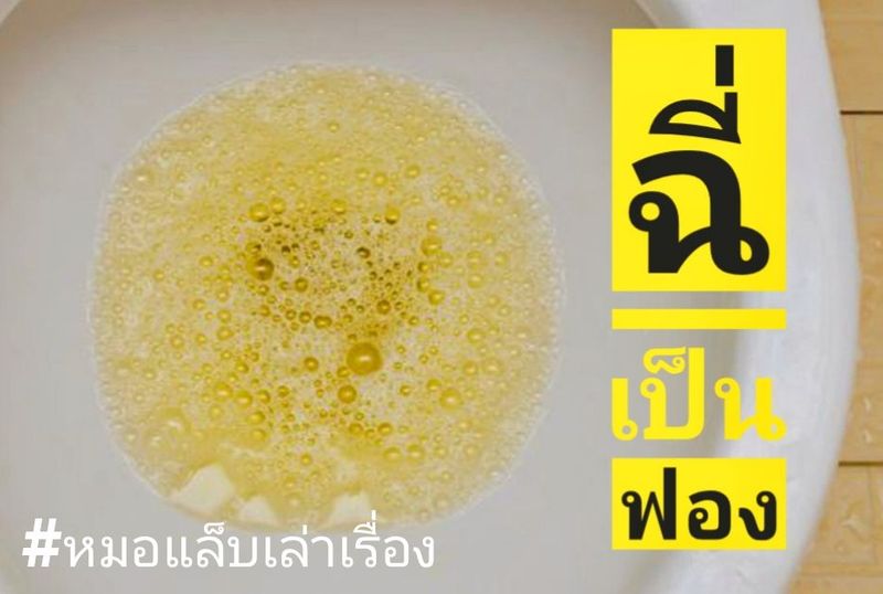 หมอแล็บเล่าเรื่อง ปัสสาวะเป็นฟองระวังโรตไต โดยปกติ คนเราจะมีการปัสสาวะเป็นฟองได้บ้าง ในกรณี