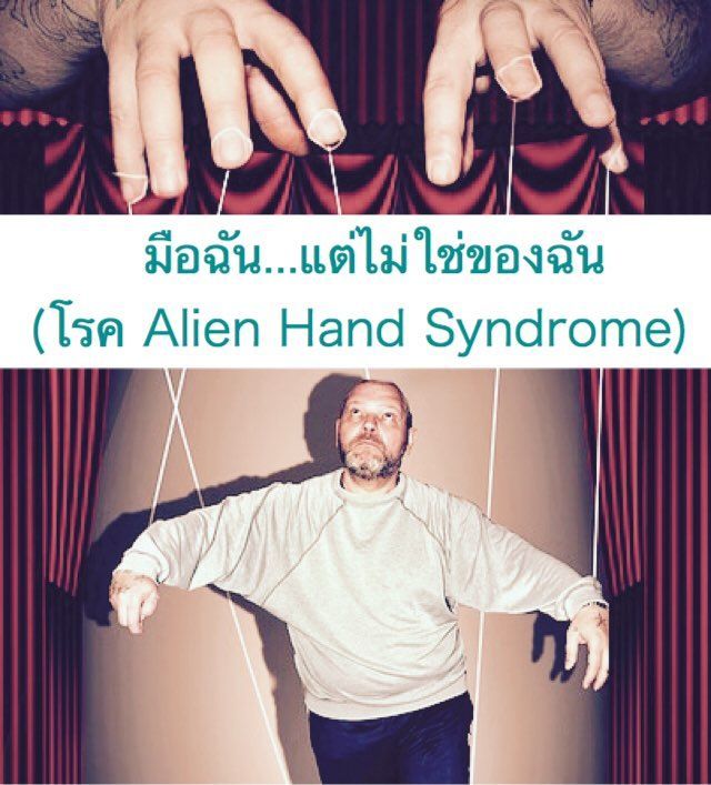 [หนังหลายมิติ] มือฉัน...แต่ไม่ใช่ของฉัน (โรค Alien Hand Syndrome) ลอง ...