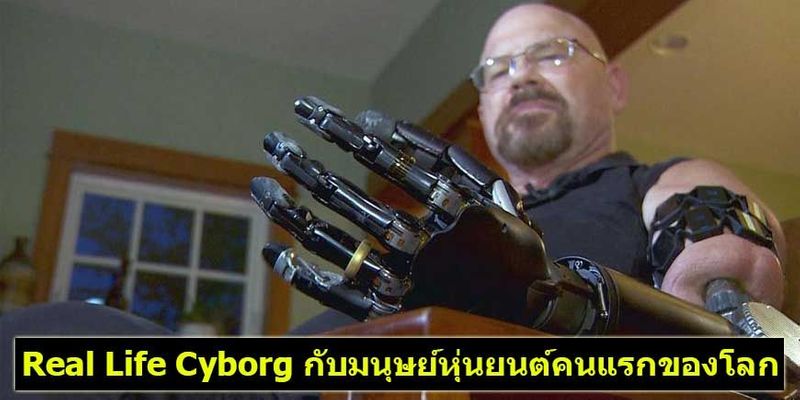 [ด.ดล Blog] Real Life Cyborg กับมนุษย์หุ่นยนต์คนแรกของโลก เทคโนโลยีใน ...