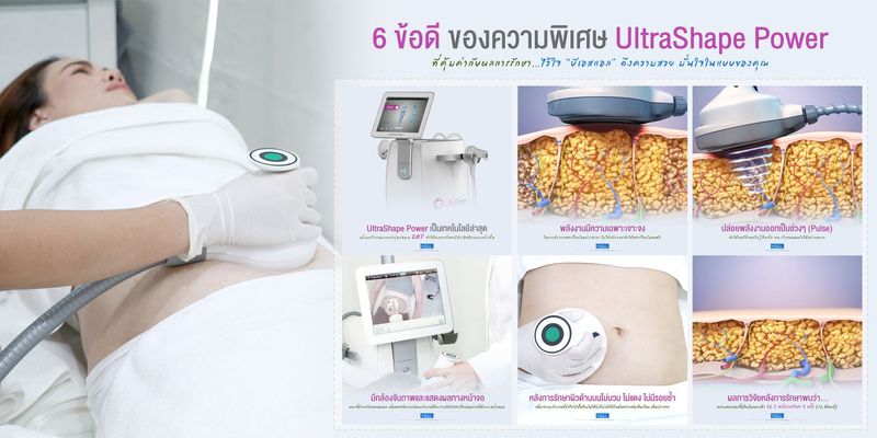 [BSL Clinic] 6 ข้อดี...ความพิเศษของ UltraShape Power ที่คุ้มค่ากับผลการ ...