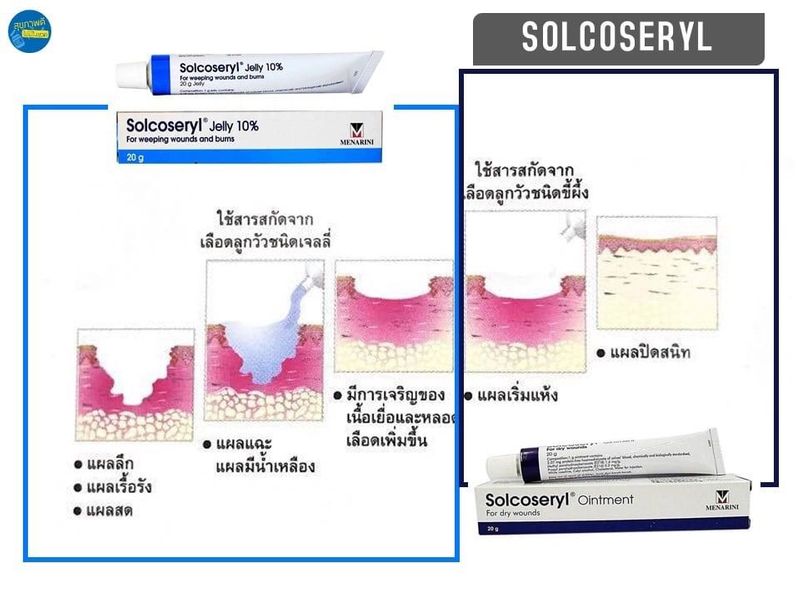 [สุขภาพดีไม่มีในขวด] Solcoseryl บาดแผล คือการบาดเจ็บของร่างกายที่ทำให้ ...