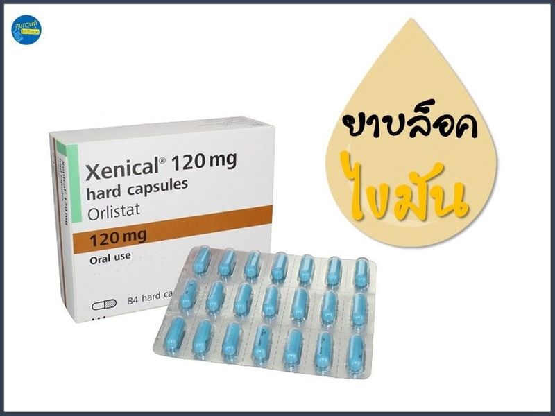 [สุขภาพดีไม่มีในขวด] ยาบล็อคไขมัน Xenical Orlistat คือชื่อยาที่รู้จัก ...