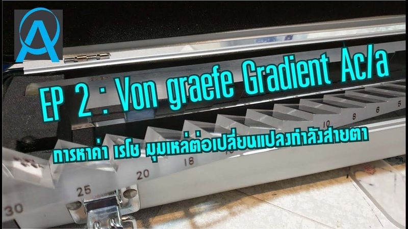 [Agate Optical] EP 2 : Von Graefe Gradient Ac/a มีปัญหาสายตาชมทางนี้