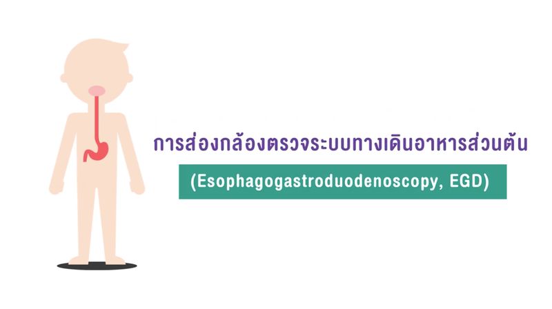 [Sriphat Medical Center ] การส่องกล้องตรวจระบบทางเดินอาหารส่วนต้น ...