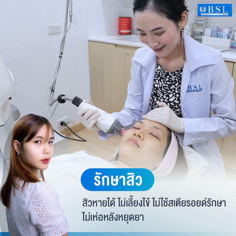 [BSL Clinic] ไม่ว่าคุณจะเป็นสิวแบบใด ผ่านการรักษามาเยอะแค่ไหน สิวก็ไม่ ...