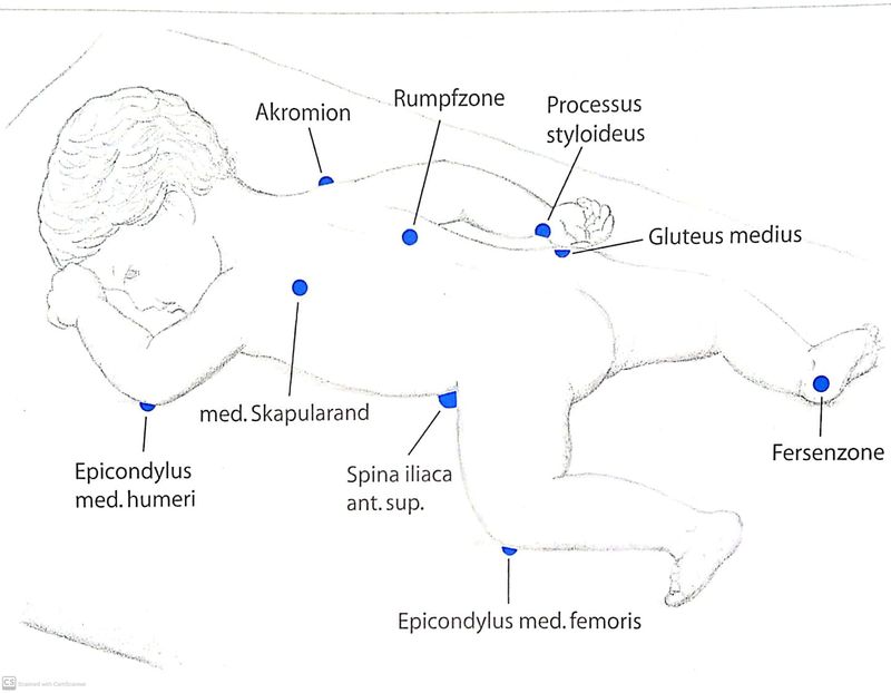 [#bedside_with_ajahn_parit] #bedside_with_ajahn_parit #vojta_theapy ว่า ...