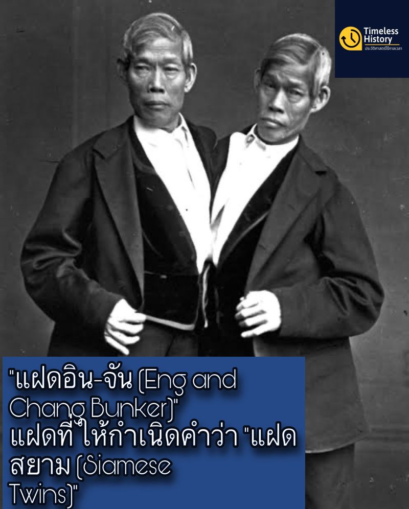 [Timeless History (ประวัติศาสตร์ไร้กาลเวลา)] “แฝดอิน-จัน (Eng and Chang ...