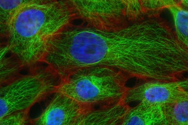 [Sarun's IT News] ขั้นตอนวิธีที่จะป้องกันการระบุประเภทเซลล์มะเร็งผิดพลาด ขั้นตอนวิธีการเรียนรู้ ...