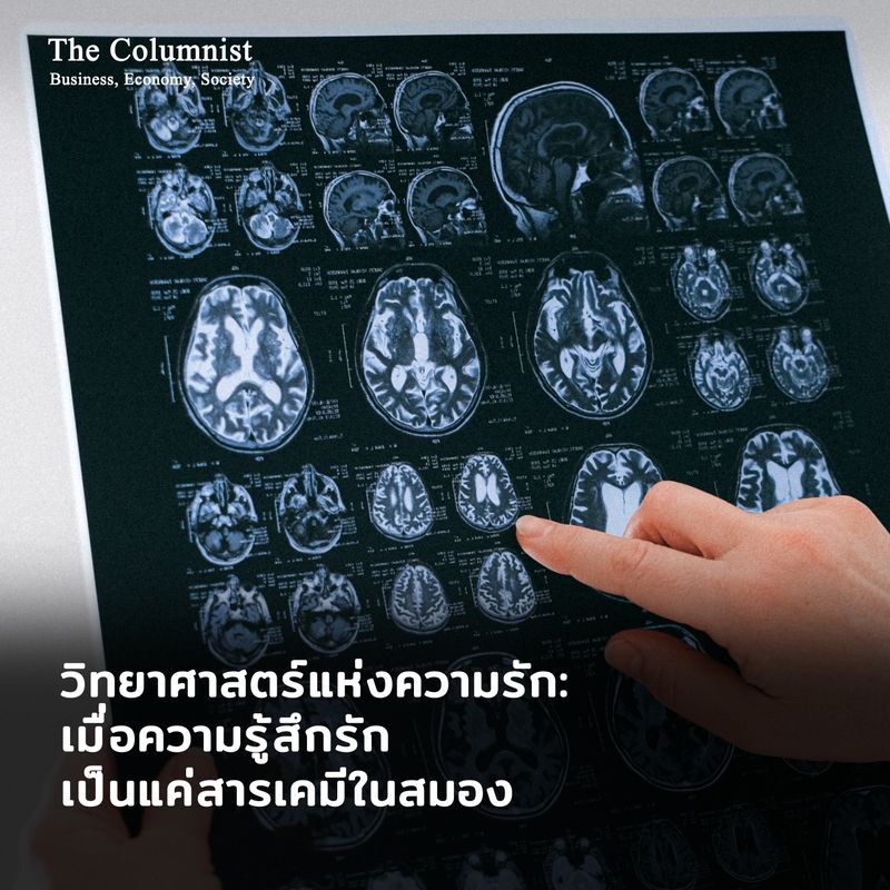 [The Columnist] เมื่อความรู้สึกรัก เป็นแค่เคมีในสมอง คุณรักเขา เพราะคุณ ...