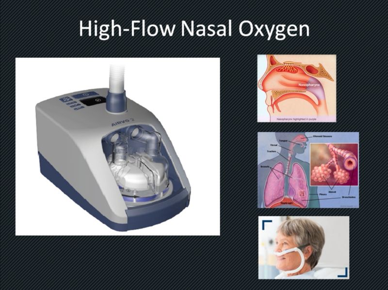 [หนอนน้อยอ่านเปเปอร์] รีวิว High-flow Nasal Oxygen in Adults (เน้นรู้ ...