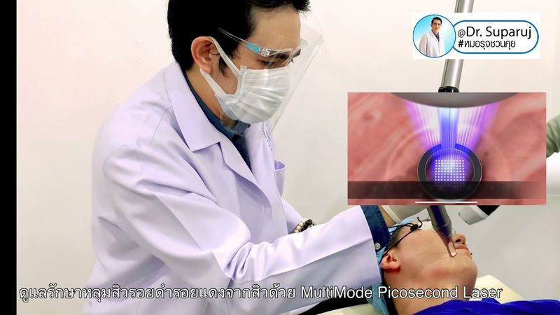[หมอรุจชวนคุย Dr. Suparuj ผมผิวสิวหลุมสิวแผลเป็น] 📍ดูแล หลุมสิว รูขุมขนกว้างด้วย Picosecond ...