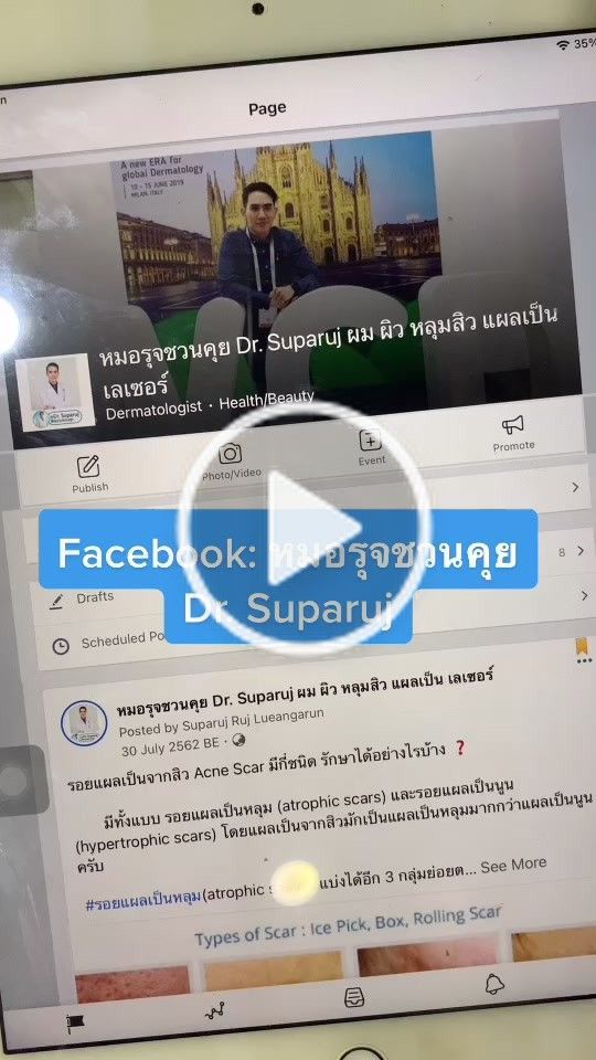 [หมอรุจชวนคุย Dr. Suparuj ผมผิวสิวหลุมสิวแผลเป็น] 📍รบกวนฝากติดตามข้อมูลร้านการดูแลรักษาทุกปัญหา ...