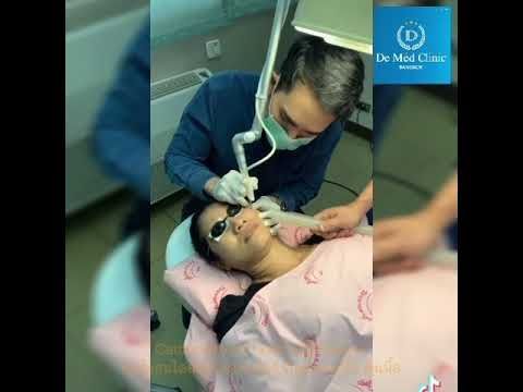 [หมอรุจชวนคุย Dr. Suparuj ผมผิวสิวหลุมสิวแผลเป็น] 📍ดูแล กระเนื้อ ติ่งเนื้อ ด้วย CO2 Laser 👨‍⚕️😉🔬 ...