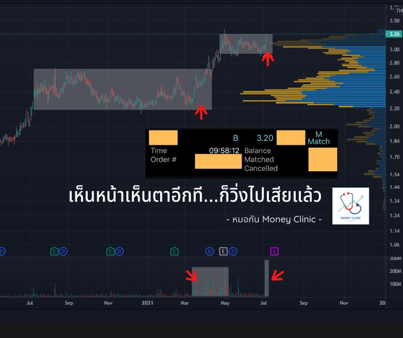 [Money Clinic] เห็นหน้าเห็นตาอีกที ก็วิ่งไปเสียแล้ว หลีกเลี่ยงไม่ได้ที่ ...