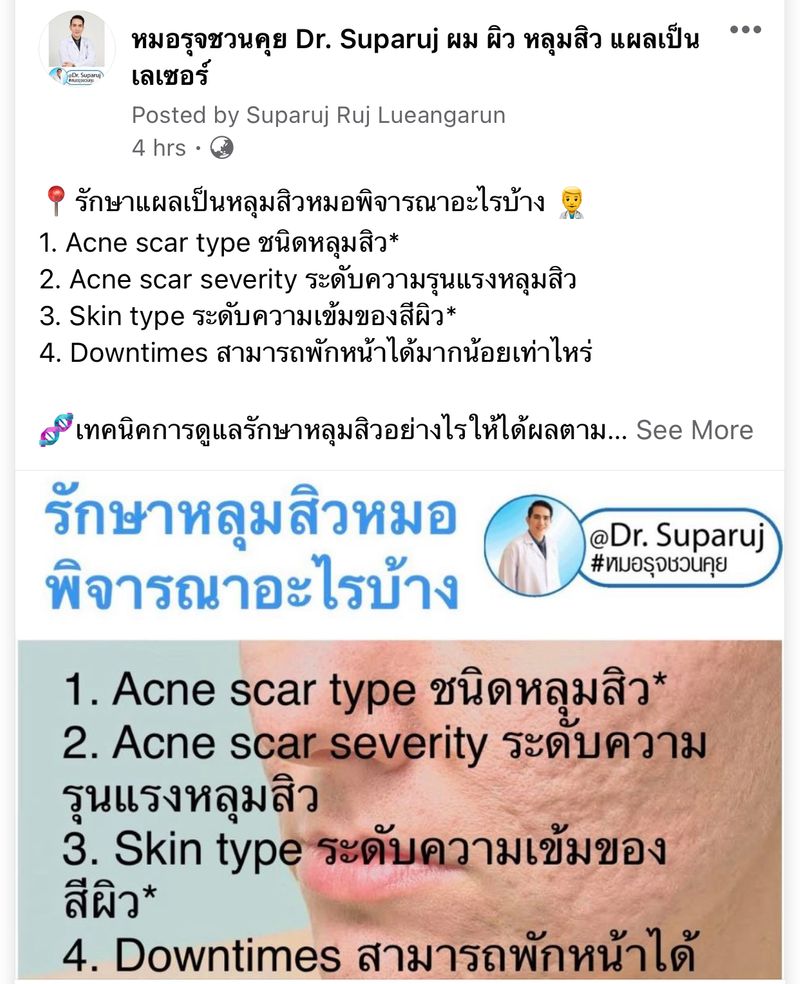 [หมอรุจชวนคุย Dr. Suparuj ผมผิวสิวหลุมสิวแผลเป็น] 📍รักษาแผลเป็นหลุมสิวหมอพิจารณาอะไรบ้าง 👨‍⚕️ 1 ...