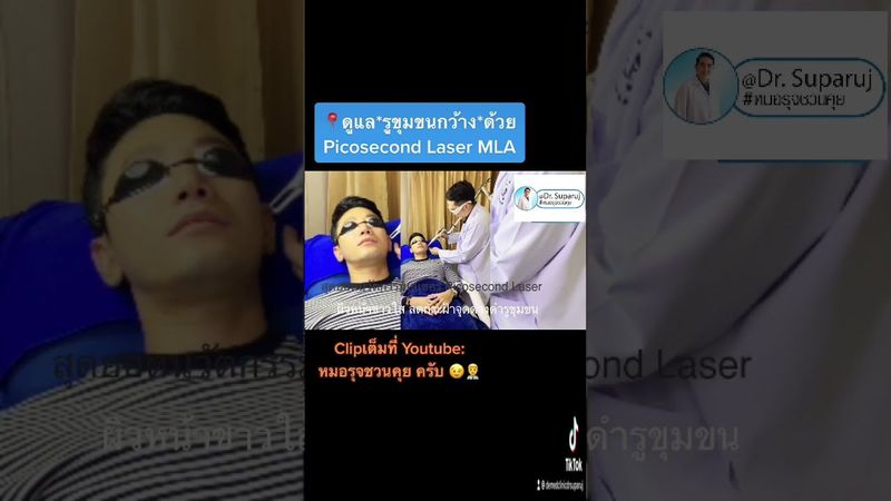 [หมอรุจชวนคุย Dr. Suparuj ผมผิวสิวหลุมสิวแผลเป็น] 📍ดูแล*รูขุมขนกว้าง* ด้วย Picosecond Laser #รู ...