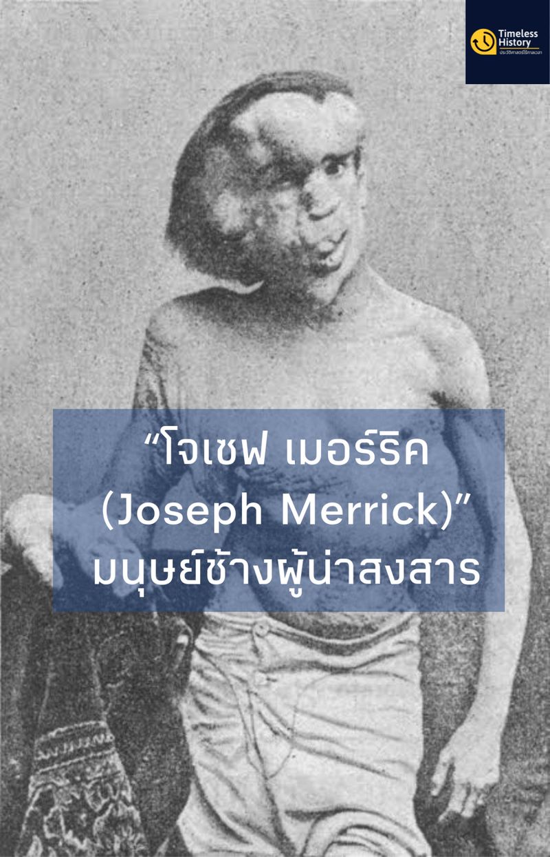 [Timeless History (ประวัติศาสตร์ไร้กาลเวลา)] “โจเซฟ เมอร์ริค (Joseph ...
