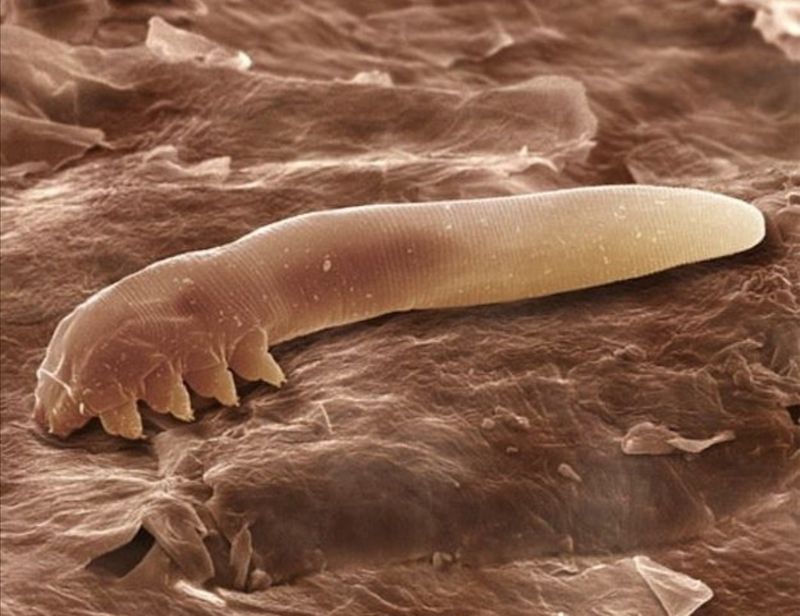 [หมออัฑฒ์ แพทย์ทางไกล] รู้จัก demodex หนอนบนหน้าคน ในตำราแพทย์แผนโบราณ ...