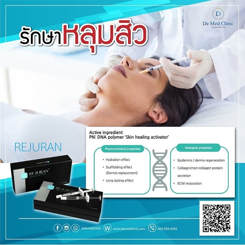 [หมอรุจชวนคุย Dr. Suparuj ผมผิวสิวหลุมสิวแผลเป็น] 📍รักษาหลุมสิวด้วยเทคนิคจากเกาหลี🇰🇷 Nokor ...