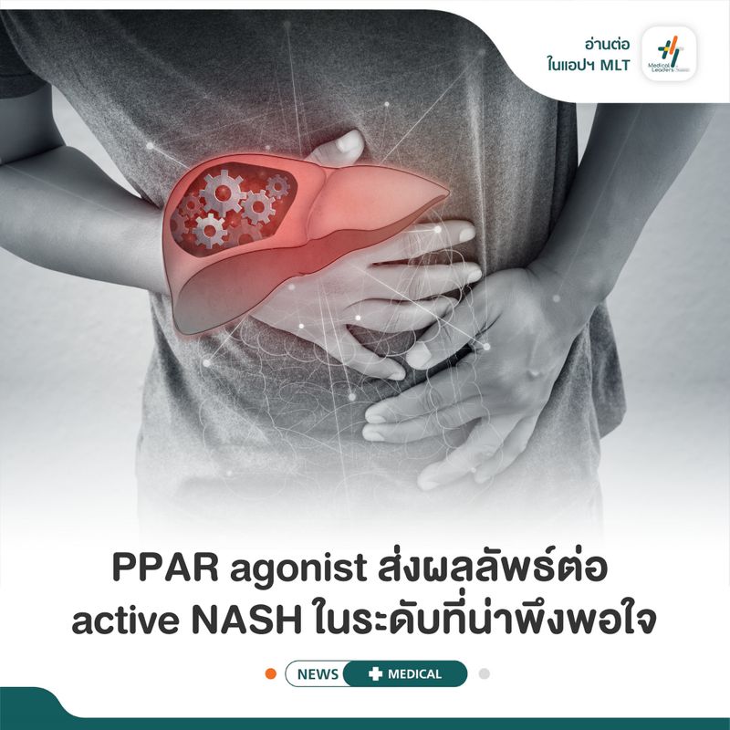 [Medical Leaders Thailand - MLT] การศึกษา phase 2b RCT ต่อ lanifibranor ...