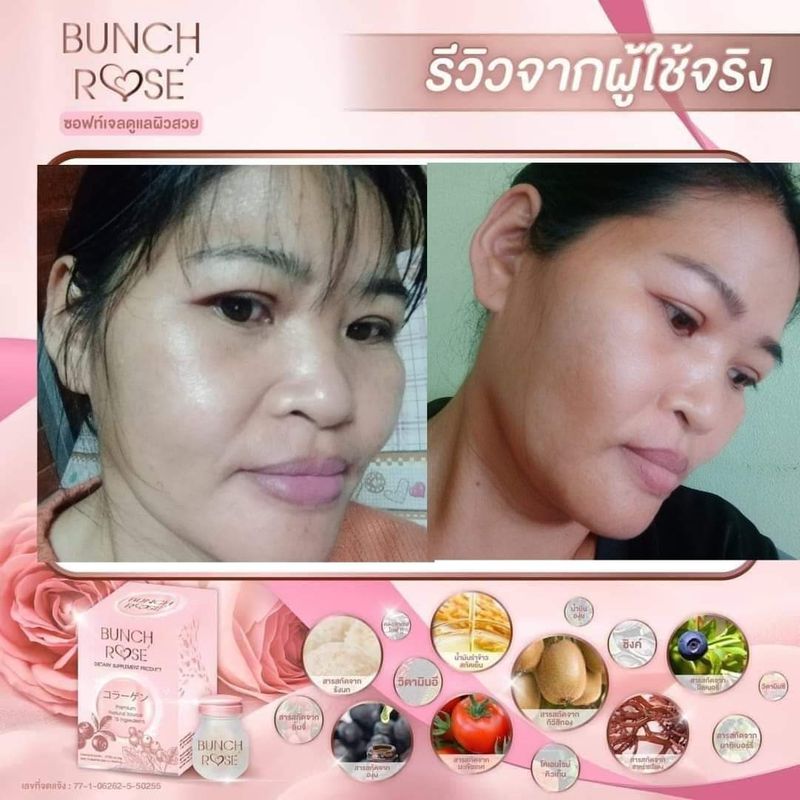 [Droprich ที่คุณเป็นเจ้าของธุรกิจ] #Bunch rose คอลลาเจน เพิ่มความขาวใสให้กับผิว ดูอ่อนเยาว์