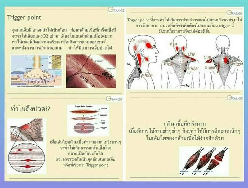 [Young Fit] เมื่อวานไปเจออันนี้มา ดีมาก อธิบายเรื่องพังผืด และเส้นที่ ...