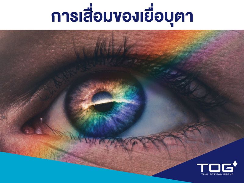 [Thai Optical Group] การเสื่อมของเยื่อบุตาบริเวณที่ชิดกับขอบตาดำเรียก ...