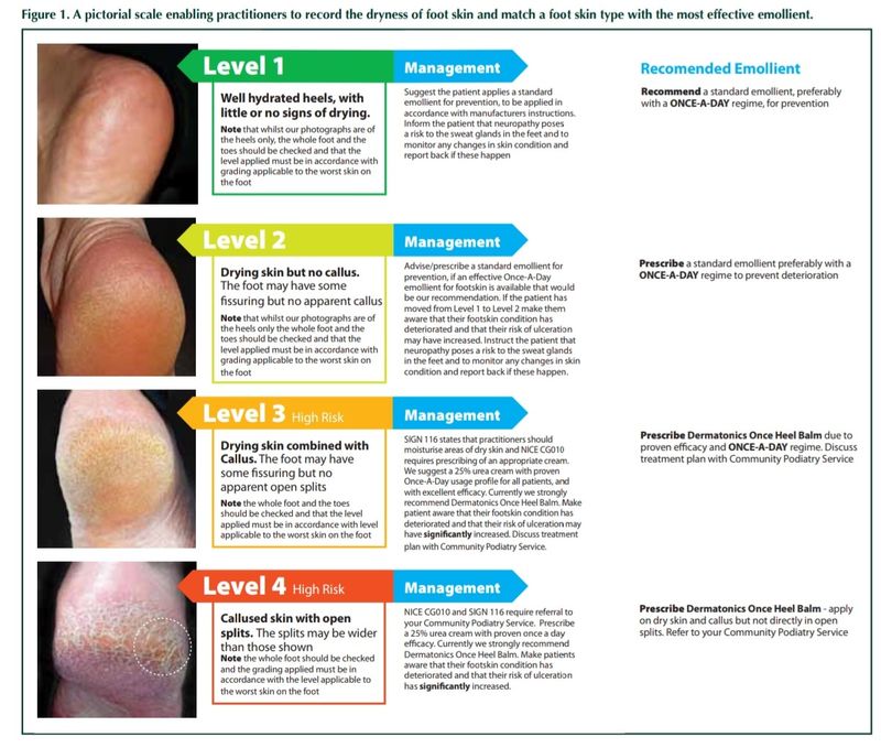 [BETTERCM] 🔰ส้นเท้าแตก - Dry Heel fissures / Cracked heel 🔰 เป็นภาวะที่ ...