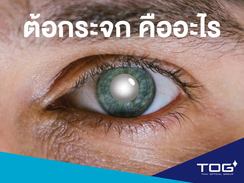 [Thai Optical Group] ต้อกระจก เป็นโรคที่เกิดจากเลนส์แก้วตาเสื่อมสภาพ ...