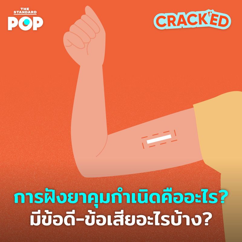 [THE STANDARD POP] การฝังยาคุมกำเนิดคืออะไร? มีข้อดี-ข้อเสียอะไรบ้าง ...