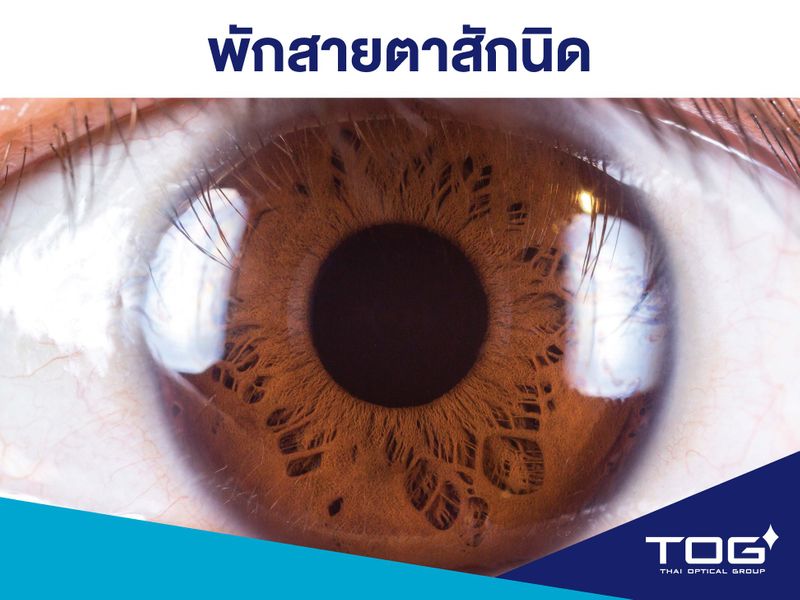 [Thai Optical Group] การกระพริบตาถี่ๆ เป็นการพักสายตาแบบหนึ่ง การ ...