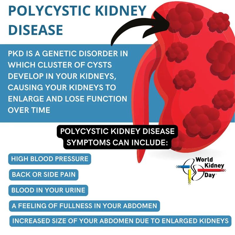 [sakchaisukontachad] PKD is a form of #CKD that reduces #KidneyFunction ...