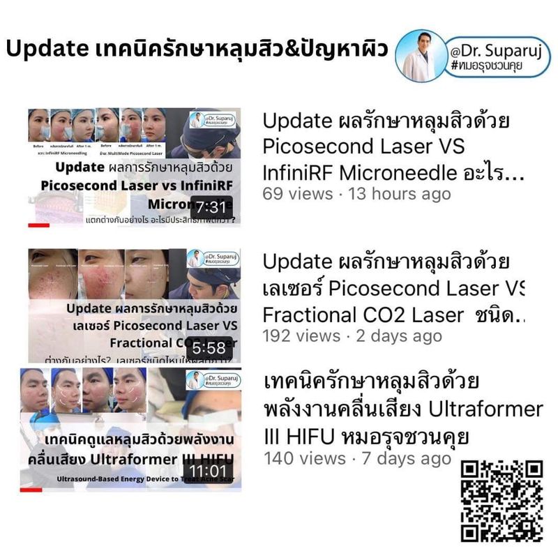 [หมอรุจชวนคุย Dr. Suparuj ผมผิวสิวหลุมสิวแผลเป็น] 📍Update เทคนิครักษาหลุมสิว & ปัญหาผิว 👨‍⚕️หมอ ...