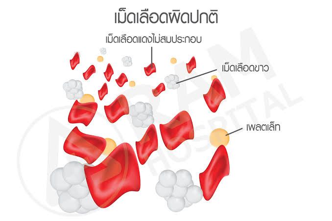 [Test Page BCNU] Blog 82 (17/09/22)