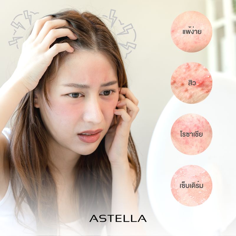 [ASTELLA คืนความมั่นใจให้คนผิวแพ้ง่าย โรซาเชีย] ถ้าคุณท้อแท้ เหนื่อยใจ ...