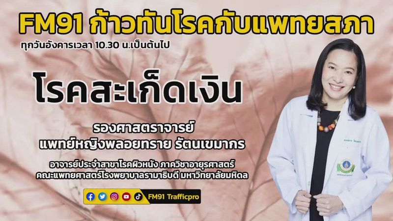 [FM91 Trafficpro] โรคสะเก็ดเงิน : FM91 ก้าวทันโรคกับแพทยสภา สัมภาษณ์ รองศาสตราจารย์ แพทย์หญิง ...