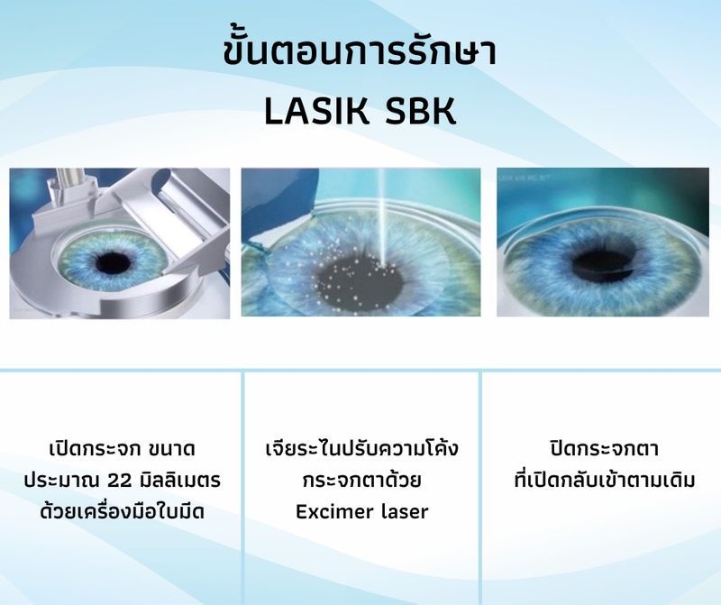 [หมอตุลยาเลสิค DrTulaya Community] LASIK SBK ศึกษาข้อมูลเพิ่มเติมได้ที่ ...