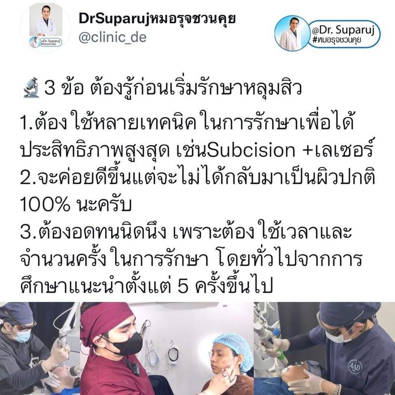 [หมอรุจชวนคุย Dr. Suparuj ผมผิวสิวหลุมสิวแผลเป็น] 📍3 ข้อ ต้องรู้ก่อนเริ่มรักษาหลุมสิว 1.แผลเป็น ...