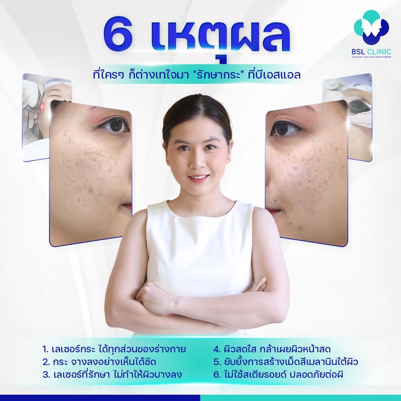 [BSL Clinic] ห้ามพลาด😲 6 เหตุผล ที่ใครๆ ก็ต่างเทใจมา "รักษากระ ฝ้า" ที่ ...