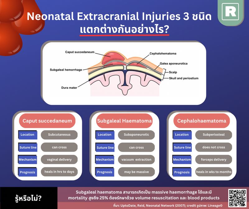 [Round Medicine] LongtunMed เพื่อการเตรียมสอบ NL2: Ep.1 สรุป Neonatal ...