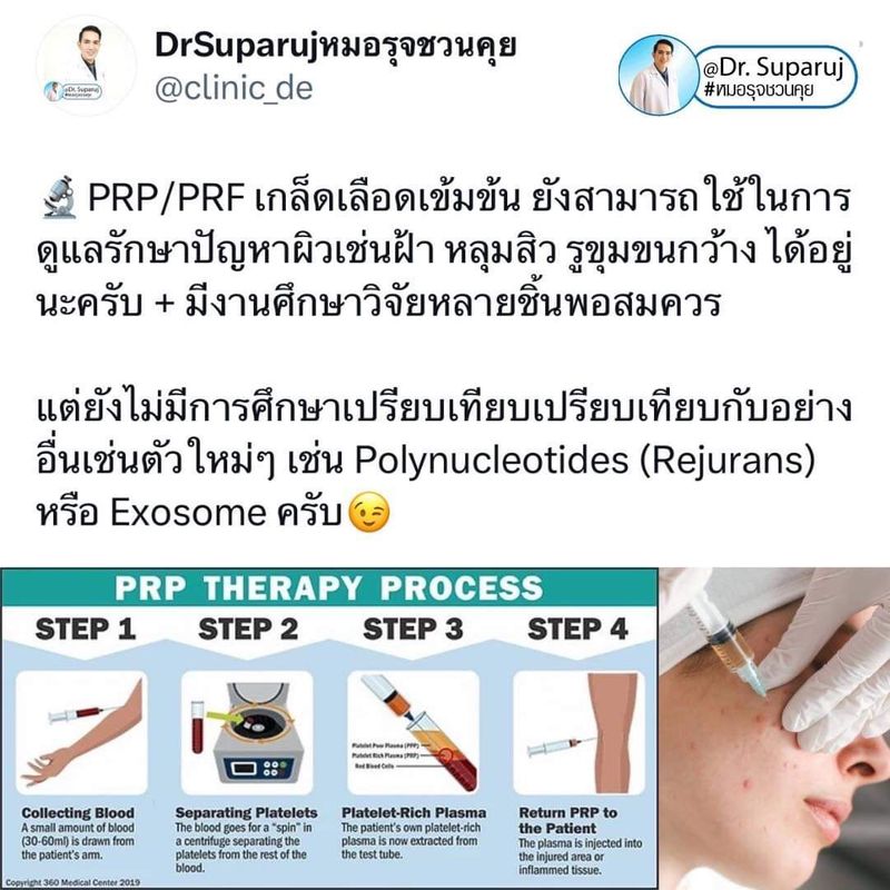 [DeMed Skin Product เวชสำอางคุณภาพ สิว ฝ้า ผมร่วง] 📍 🔬PRP/PRF เกล็ด ...