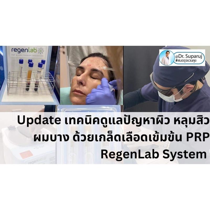 [หมอรุจชวนคุย Dr. Suparuj ผมผิวสิวหลุมสิวแผลเป็น] 📍 Update เทคนิคดูแลปัญหาผิว หลุมสิว ผมบาง ...