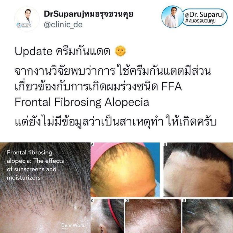 [หมอรุจชวนคุย Dr. Suparuj ผมผิวสิวหลุมสิวแผลเป็น] 🔬Update ครีมกันแดด🌞 จากงานวิจัยพบว่าการใช้ครีม ...