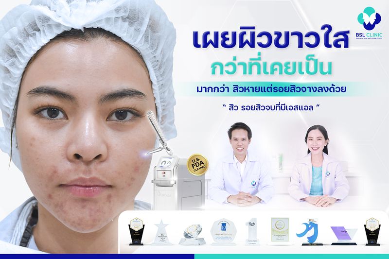 [BSL Clinic] เผยผิวกระจ่างใสกว่าที่เคยเป็น มากกว่า สิวหายแต่รอยดำสิวจาง ...