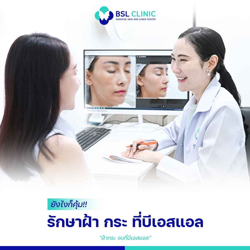 [BSL Clinic] ครๆ ก็บอก “รักษาฝ้ากระ ที่บีเอสแอลยังไงก็คุ้ม” 🎉 ฝ้าจางลง ...