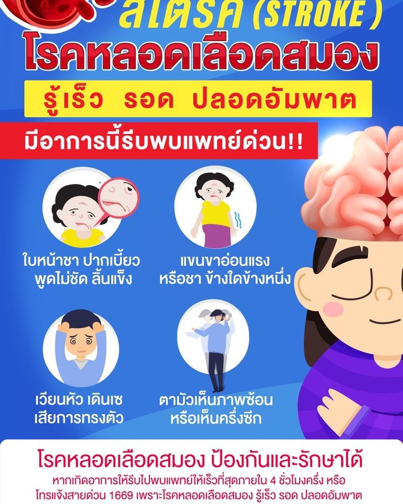 [เบื่อเมือง] "สโตรค โรคหลอดเลือดสมอง" (moon unwell) มีอาการนี้ พบแพทย์ ...