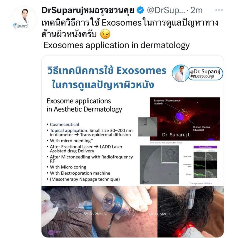[หมอรุจชวนคุย Dr. Suparuj ผมผิวสิวหลุมสิวแผลเป็น] 📍 เทคนิควิธีการใช้ Exosome ในการดูแลปัญหาทาง ...