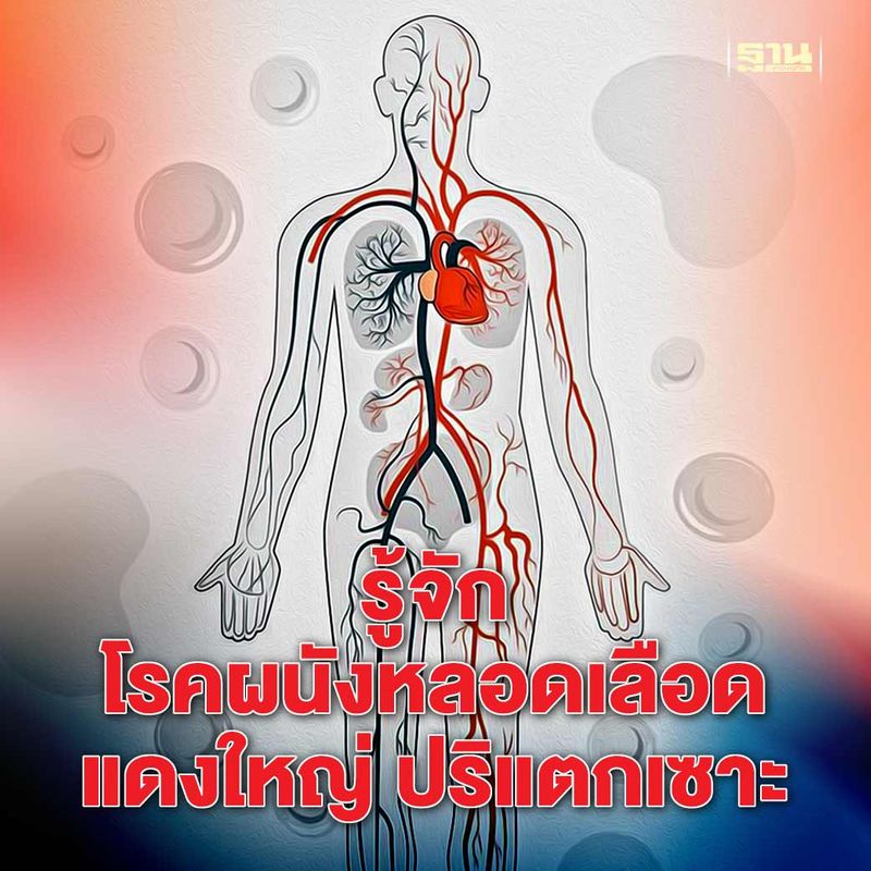 [ฐานเศรษฐกิจ_Thansettakij] ทำความรู้จักกับ โรคผนังหลอดเลือดแดงใหญ่ปริ ...