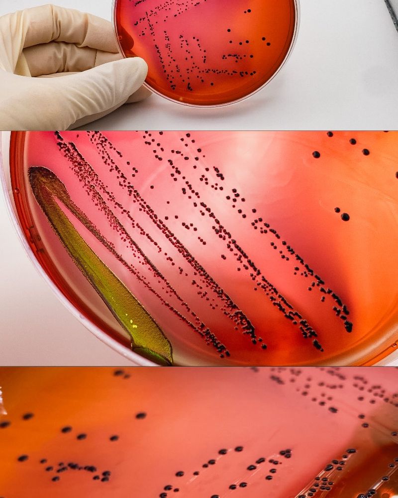 [Microbio_planet] EMB Agar - Escherichia coli Eosin Methylene Blue Agar ...