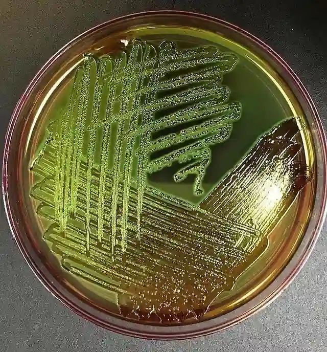 [Microbio_planet] EMB Agar - Escherichia coli Eosin Methylene Blue Agar ...